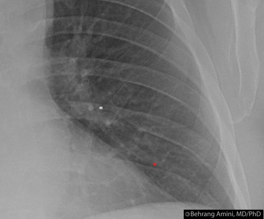 Roentgen Ray Reader: November 2011