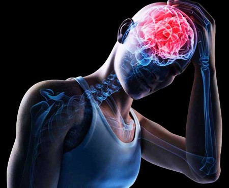 Lo que debes saber acerca de una conmoción cerebral | Web Salud
