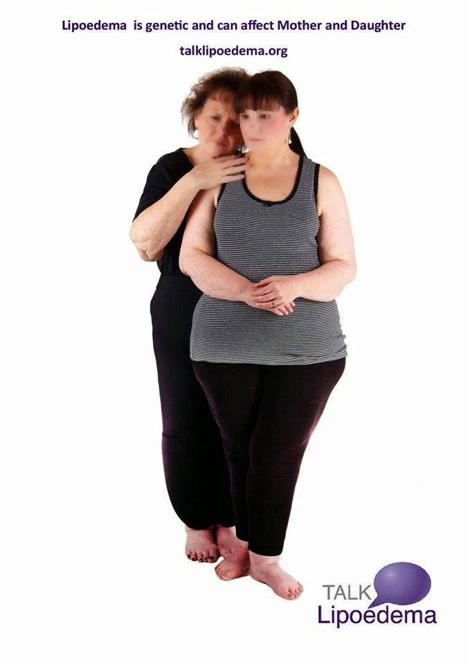 The Well-Rounded Mama: Lipedema, Part 4: Possible Causes and Associated ...