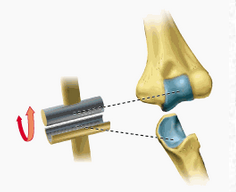 My Biology Site: Klasifikasi Sendi Berdasarkan Adanya Gerak