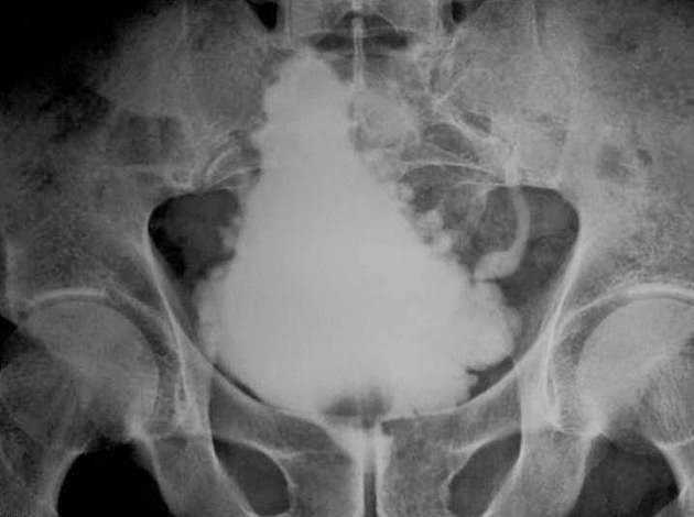 Medical Imaging: MERRY CHRISTMAS