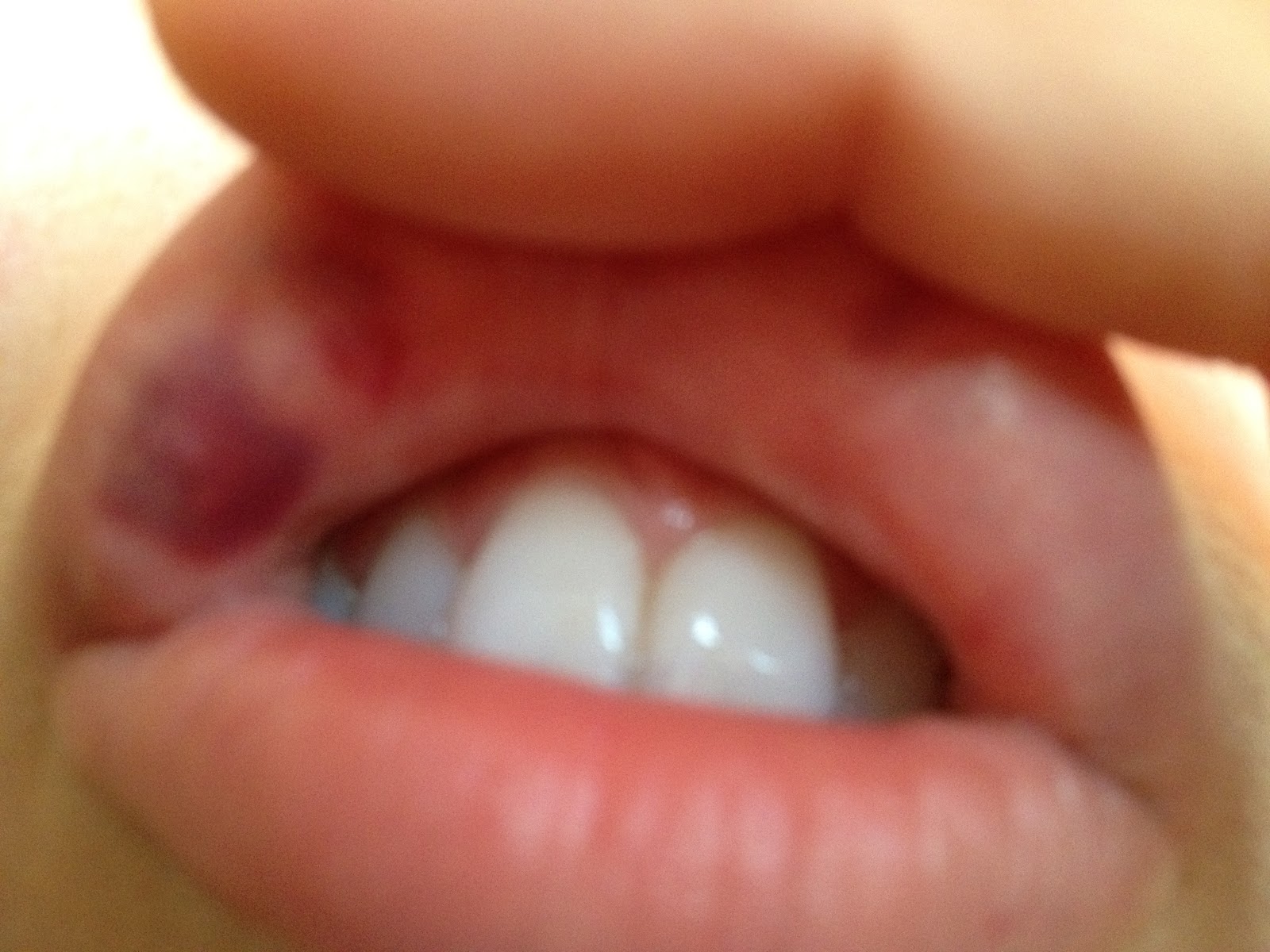 Glitter, tears & trauma: Lip Service