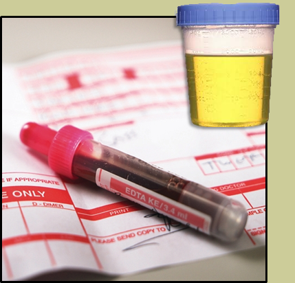 Love Your Kidneys: DIAGNOSIS TEST FOR ACUTE RENAL FAILURE