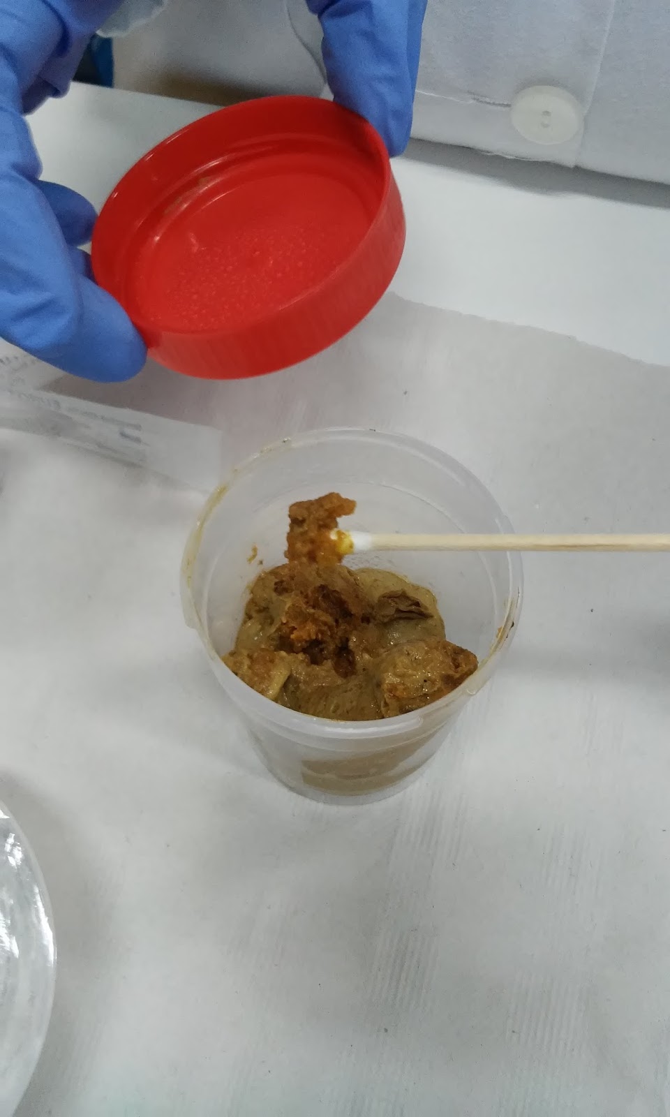 Microbiología: COPROCULTIVO