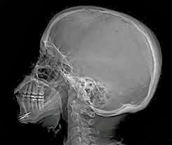 MATERI RADIOLOGI: PERBEDAAN RONTGEN,CT DAN MRI
