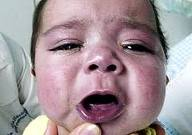 Semiologia Quirurgica. Por Esthefany De Jesus Peña: Segunda Clase