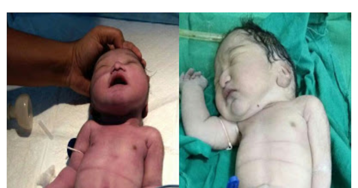 Shocking! Woman Gives Birth To ‘Real life Mermaid’ Baby (Photo) - MIMI ...