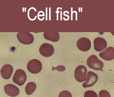 Medical Laboratory and Biomedical Science: Cell fish