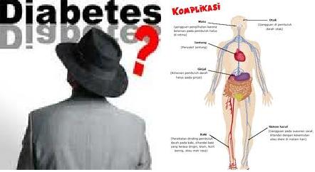 Komplikasi Diabetes I - Salsabila-Ravina