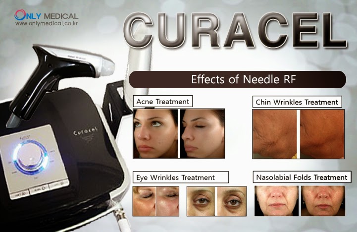 Only Medical 온리메디칼: RF Micro needle - Curacel