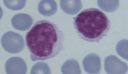 Células sanguíneas: Maduración del linfocito