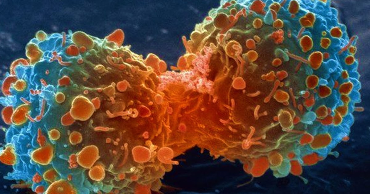 Jenis-jenis penyakit kanker, cara mencegah, serta pengobatannya ...