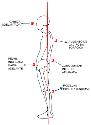 GenÉticaMente InCoRrecta: ¡Derechita!.. (¿Y si no puedo?..)