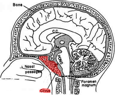 Paul Coogan, Clival Chordoma Cancer: What, Where is the Clivus