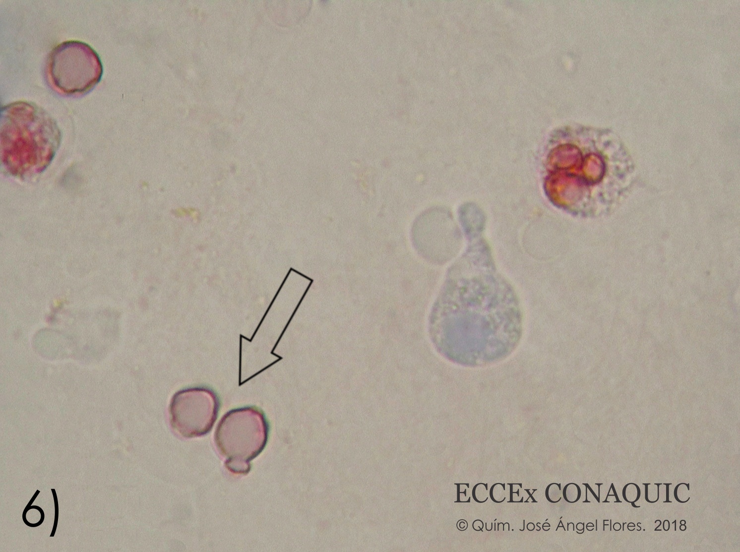 Examen General de Orina: enero 2018