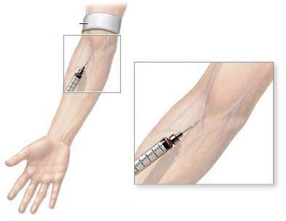 Enfermagem - 7ª Fase ESUCRI: Injeção por via endovenosa(EV) ou ...