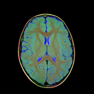 Nevit's blog: Color MRI of the Brain