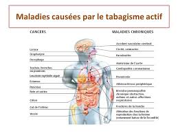 ENSEÑANZA (ENSEIGNEMENT) Y FLE-BARRANQUILLA: LE TABAC ET LA SANTÉ ...