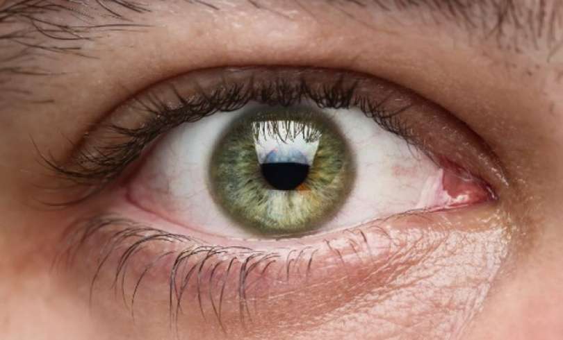 6 Scary Eye Symptoms That Says Something About Your Health - Health Queen