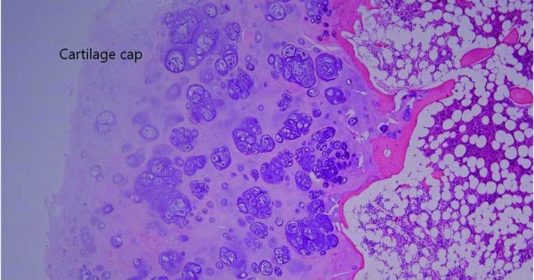 The Quest for Height: Grow Taller | Increase Height | Bone Size: Can ...