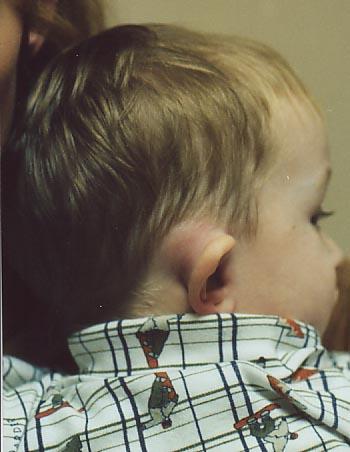 Acute Mastoiditis.ppt ~ YOUNG DOCTORS' RESEARCH FORUM