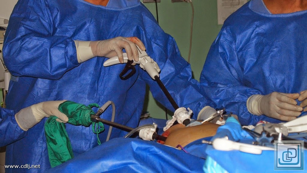 Clinica Docente Los Jarales: SIGMOIDECTOMIA LAPAROSCOPICA (Asistida por ...