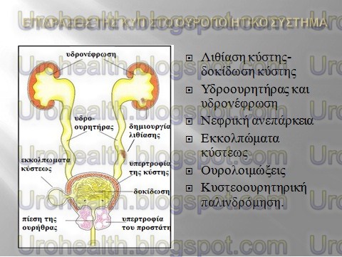 ΛΟΥΤΣΑΡΗΣ ΚΩΝΣΤΑΝΤΙΝΟΣ ΧΕΙΡΟΥΡΓΟΣ ΟΥΡΟΛΟΓΟΣ: ΥΠΕΡΤΡΟΦΙΑ ΤΟΥ ΠΡΟΣΤΑΤΗ