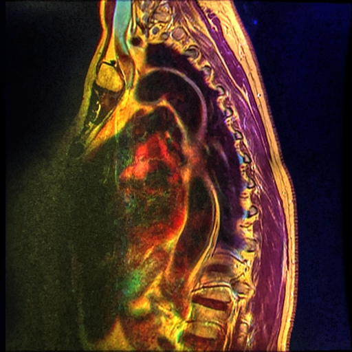 Nevit's blog: Dorsal Spine Color MRI