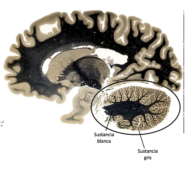 Atlas de neuroanatomía: METENCÉFALO