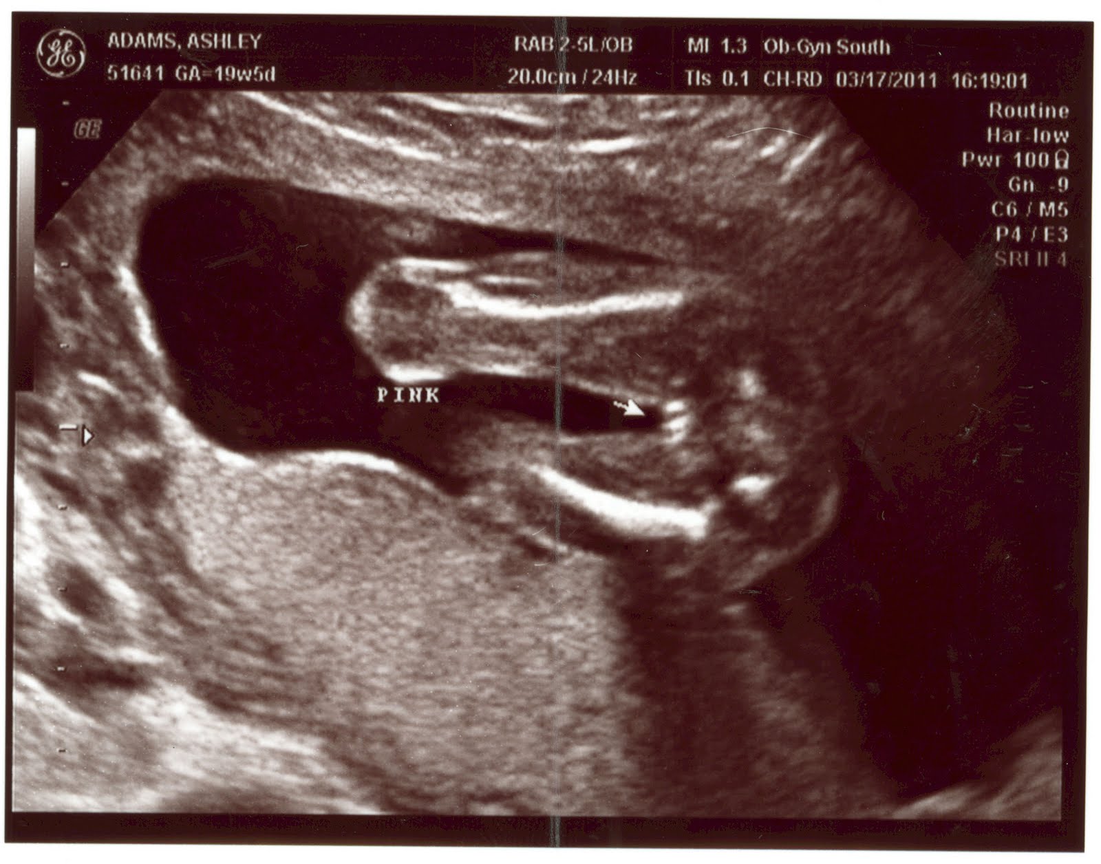 All the Fun of Baby Number One: Our 20 Week Ultrasound Pictures
