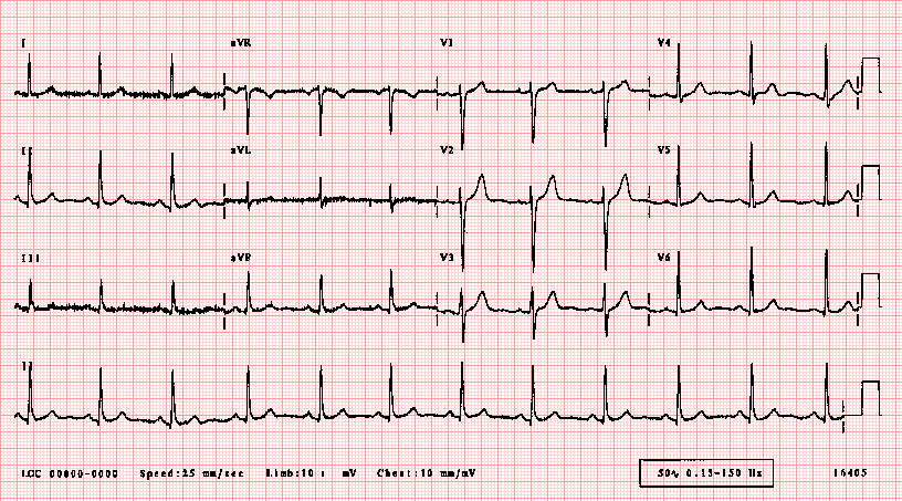 DICOM ECG