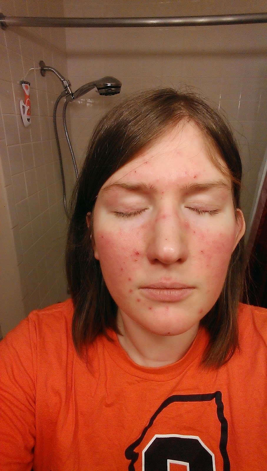 Prosacea Review: February 2015