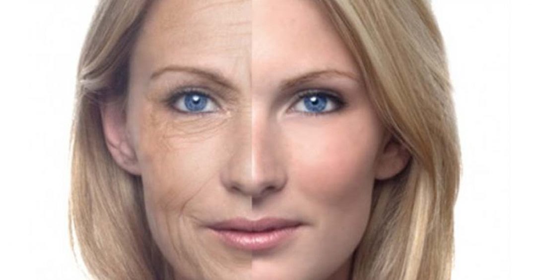 Arrugas : causas y remedios. Como eliminar las arrugas ? - Propiedades ...