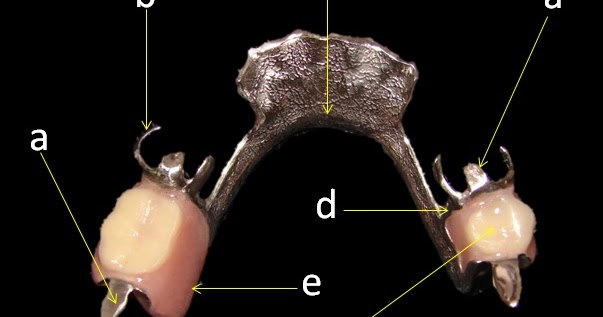 Seminario de Tecnología en Educación: PRÓTESIS PARCIAL REMOVIBLE : Parte 1