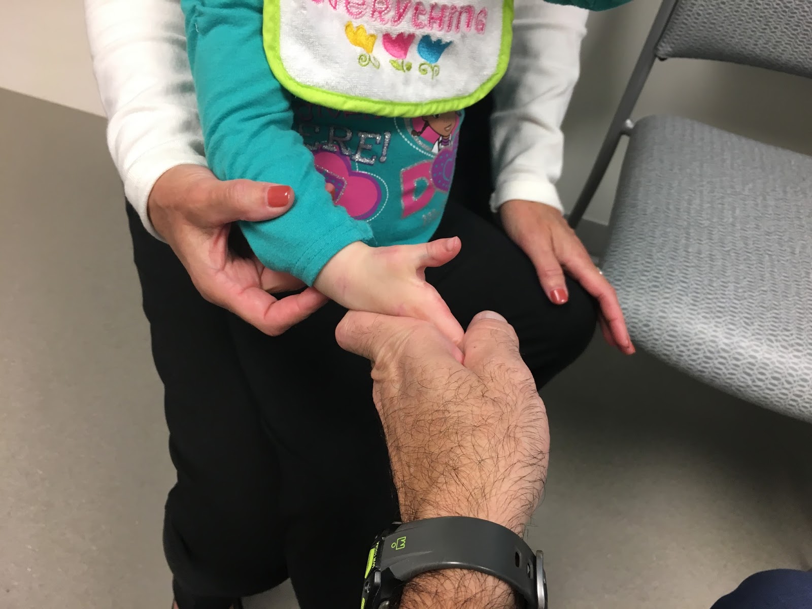 Clasped Thumb Follow Up | Congenital Hand and Arm Differences ...