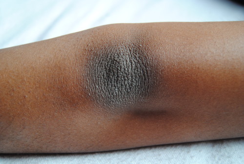 Three Simple Ways Of Removing Dry And Dark Skin On The Elbows Healthy three-simple-ways-of-removing-dry-and-dark-skin-on-the-elbows-healthy