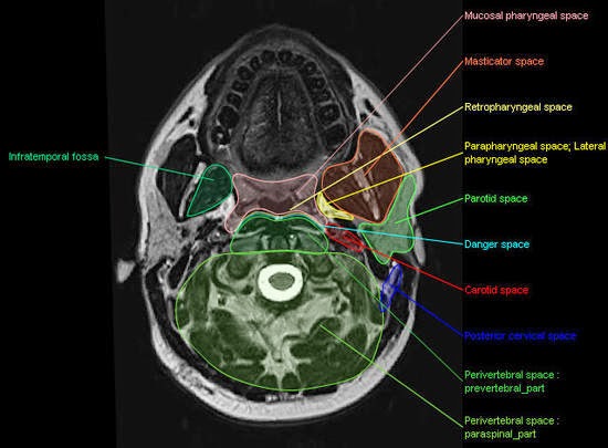 ESPE 202 - 2014: Anatomía y patología de cuello