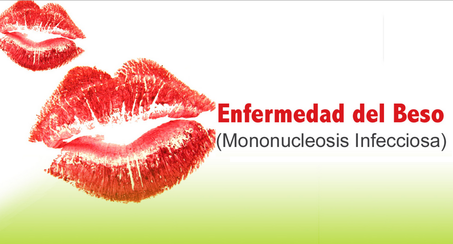 ¿Sabes lo qué es la Mononucleosis infecciosa (ENFERMEDAD DEL BESO ...
