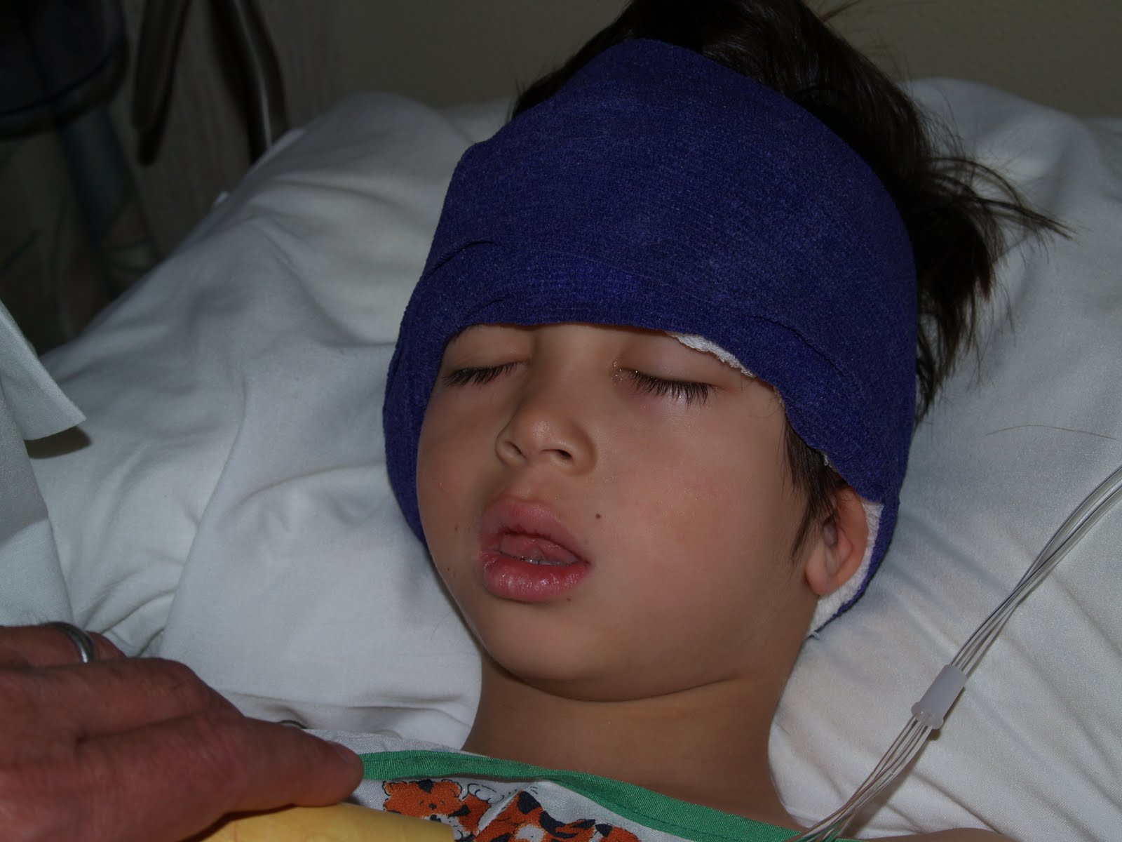 Microtia and Aural Atresia - Our Experience: Canalplasty with Dr ...