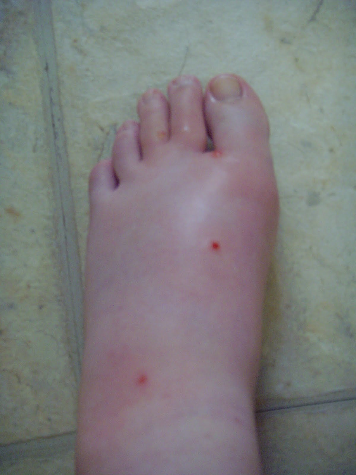 The Sly Fox Seven: Ant Bites