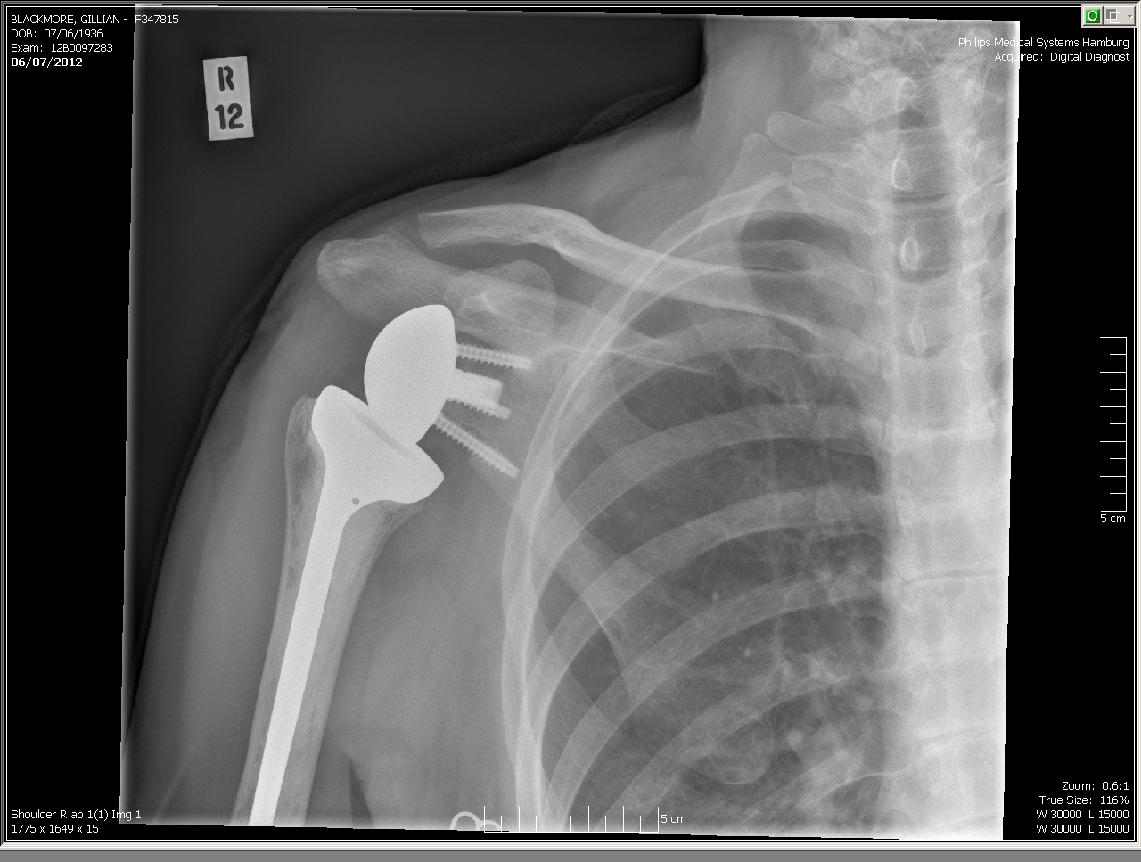 Medical Treatment Pictures-for Better Understanding: Arthroscopic ...