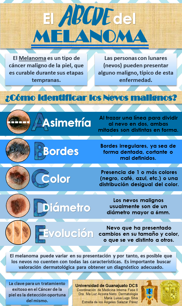 DIVULGACIÓN CIENTÍFICA UG: El ABCDE del Melanoma