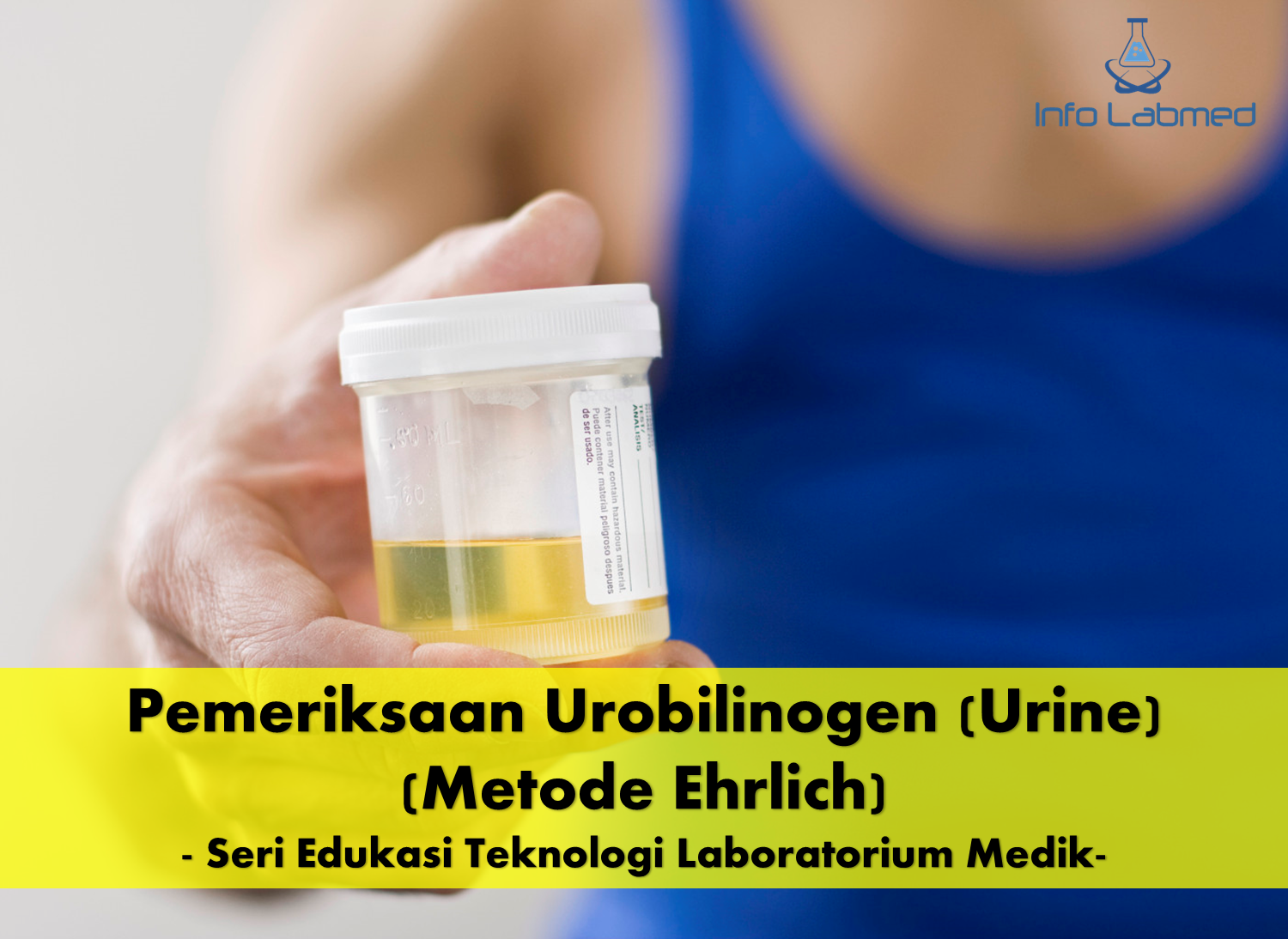 Pemeriksaan Urobilinogen (Urine) (Metode Ehrlich) | Seri Edukasi ...