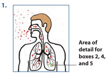 Tuberculosis (TB): Mechanism