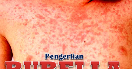 Pengertian Rubella dan Gejala Serta Pencegahannya Terlengkap - wideprison