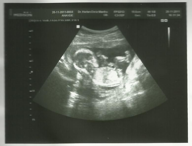 Minha 2ª gravidez: 16 semanas