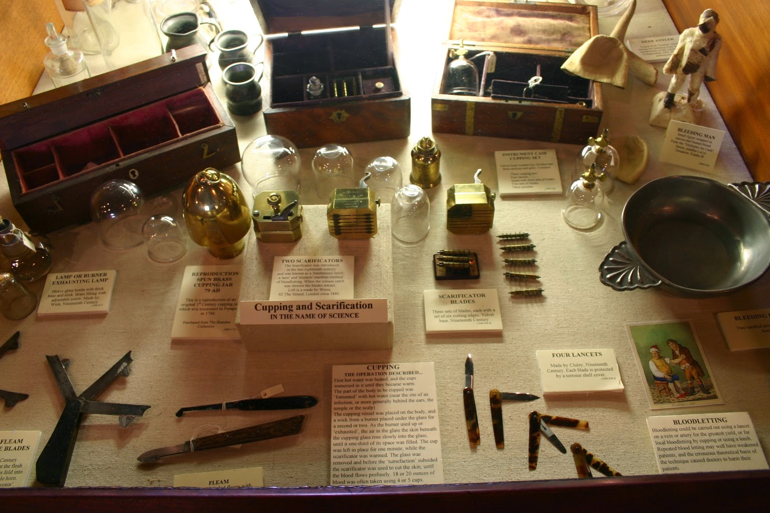 Sejarah Bekam (Hijamah) - Biologizone