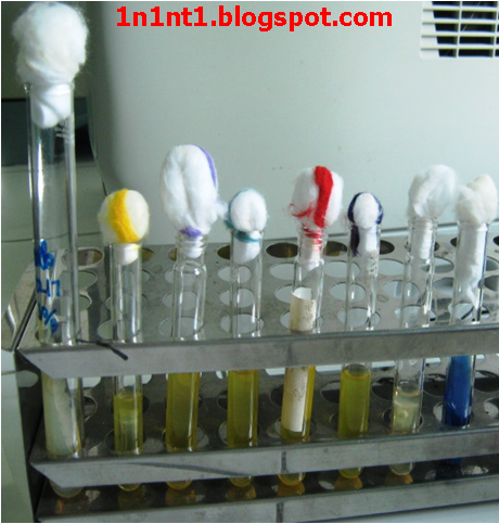 Kultur dan Hasil Uji Biokimia Bakteri Gram Negatif ~ Analis Kesehatan ...