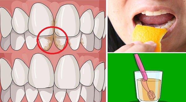 Mga Paraan Upang Maging Maputi