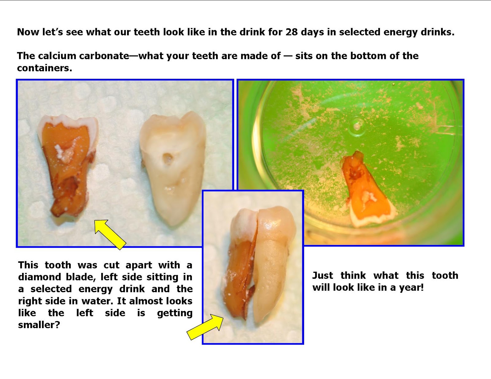 Promoting Healthy Teeth & Gums